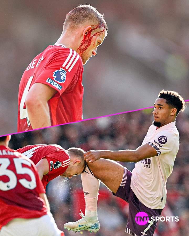 Manchester United has announced Very SAD NEWS for Matthijs de Ligt head ...
